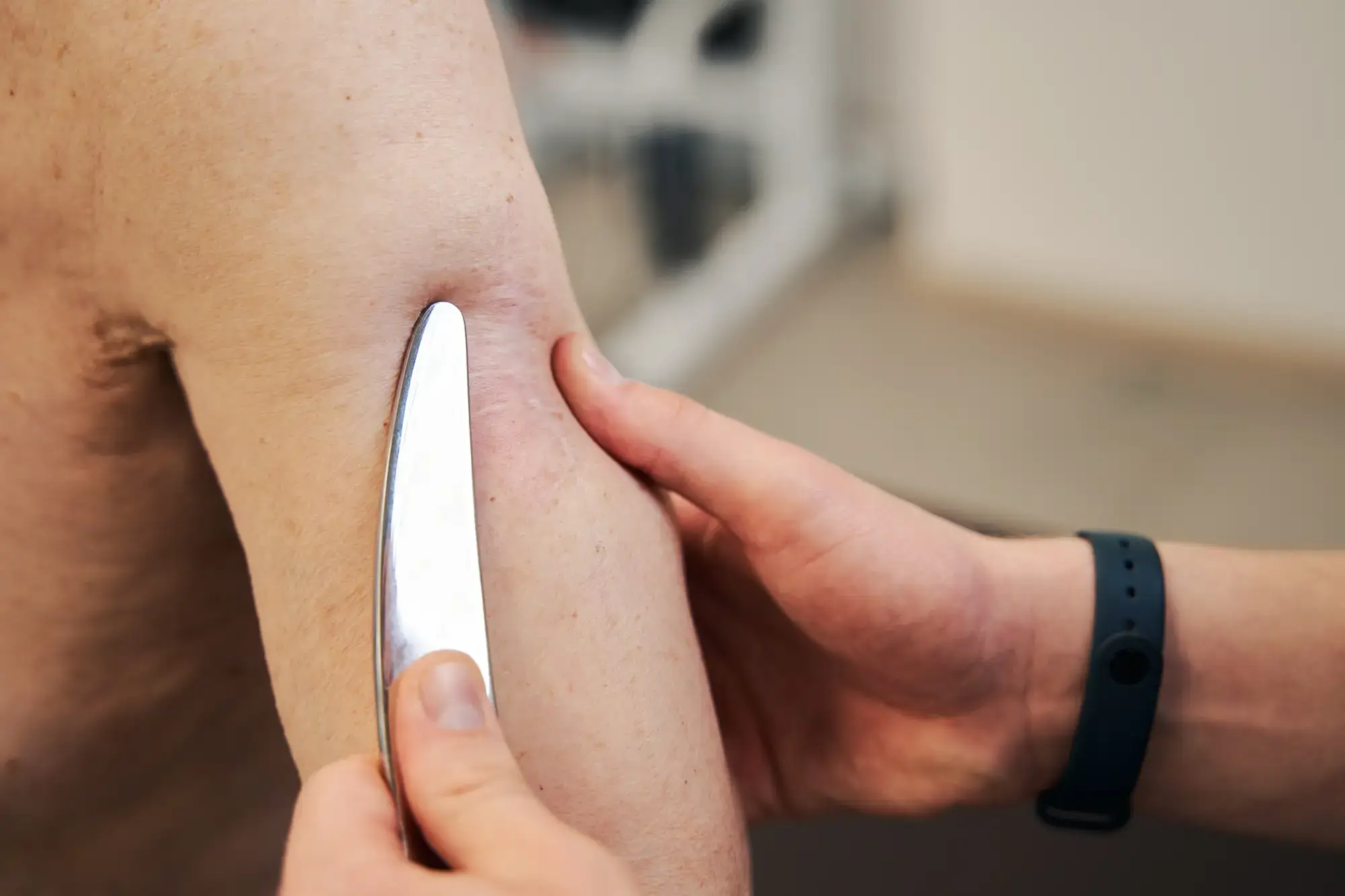 IASTM In Houston, TX | Sculpt U Physical Therapy